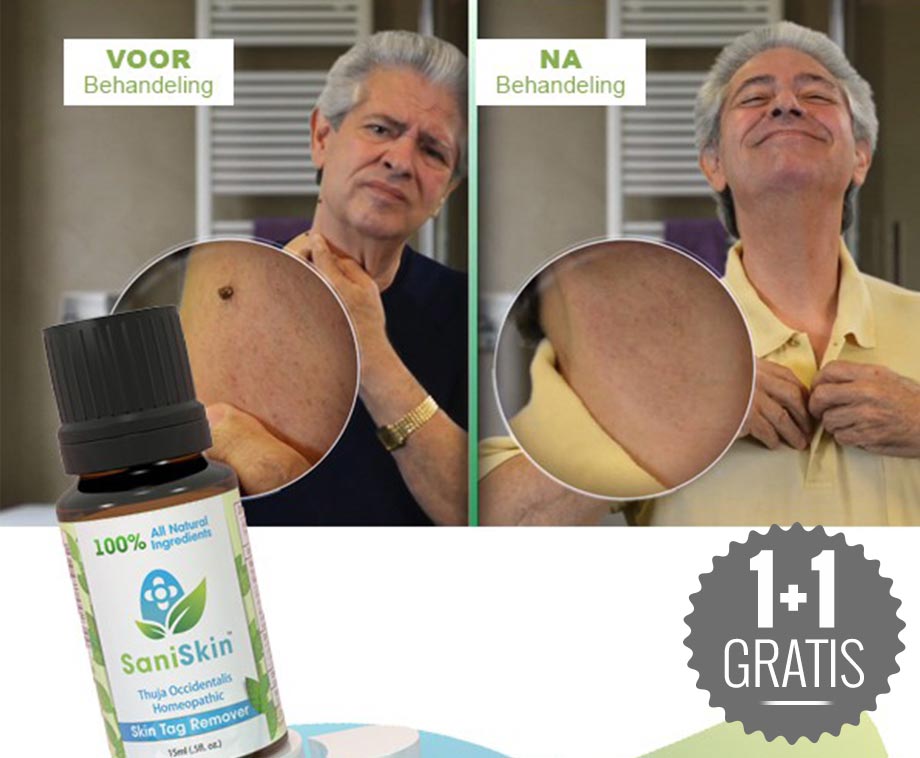 SaniSkin 1+1 GRATIS Aanbieding ⏰ | VoordeelVanger.nl